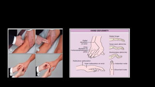 Signs and Symptoms in Rheumatology | PPTX