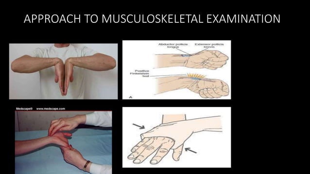 Signs and Symptoms in Rheumatology | PPTX