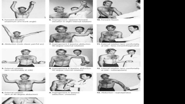 Signs and Symptoms in Rheumatology | PPTX