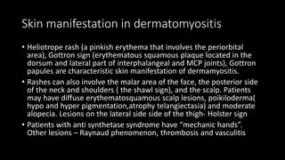 Signs and Symptoms in Rheumatology | PPTX