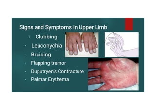 Signs and Symptoms of Liver Diseases | PDF