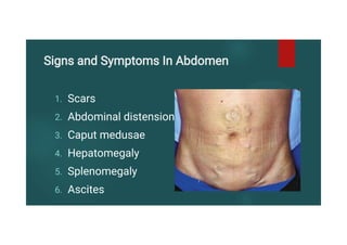 Signs and Symptoms of Liver Diseases | PPT