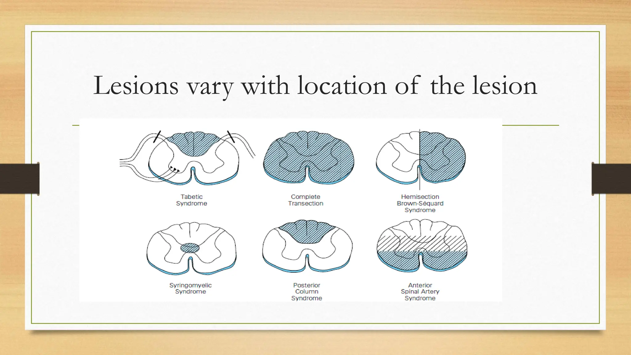 Signs and symptoms of neurological diseases new(0).pdf