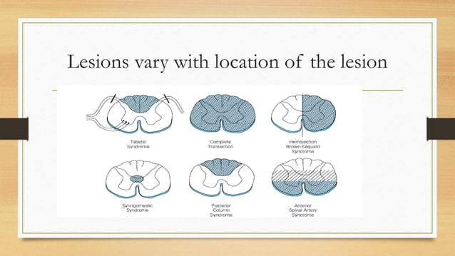 Signs and symptoms of neurological diseases new(0).pdf