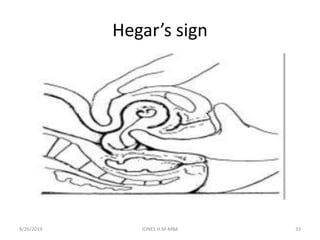 Signs and symptoms of pregnancy | PPT