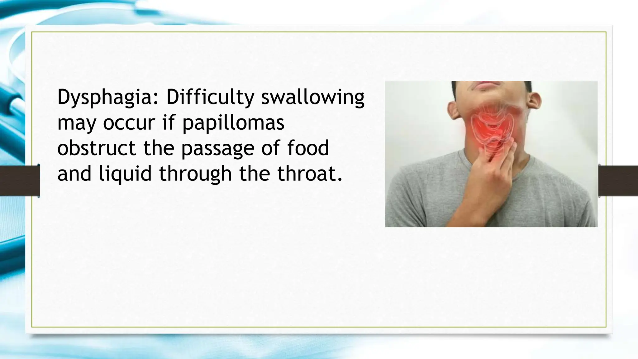 Signs and Symptoms of Recurrent Respiratory Papillomatosis | PPTX