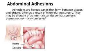 signs and symptoms of small bowel diseases.pptx