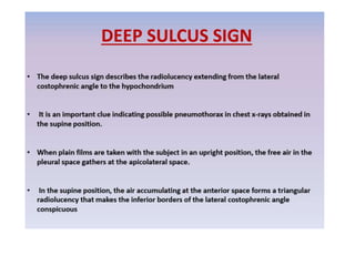 SIGNS CXR | PPTX