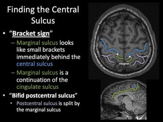 Signs in Central Sulcus of brain- common pathologies .pptx