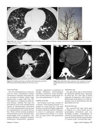 Signs in chest imaging | PDF