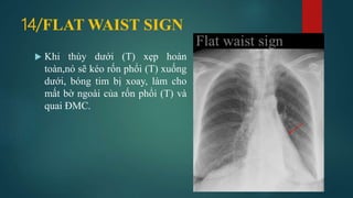 Signs in chest xray | PPTX