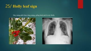 Signs in chest xray | PPTX