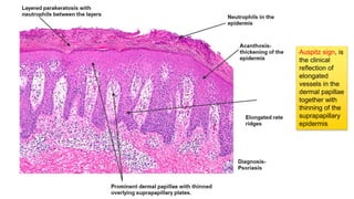 Signs in dermatology.pptx