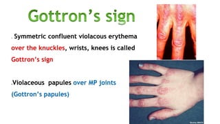 Signs in dermatology.pptx