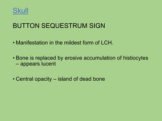 SIGNS IN EOSINOPHILIC GRANULOMA 23.03.24.pptx