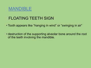 SIGNS IN EOSINOPHILIC GRANULOMA 23.03.24.pptx