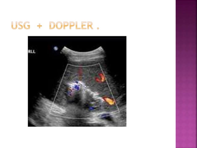 Signs in radiology | PPT