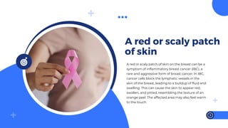 Signs of breast cancer by dr seema singh | PPT