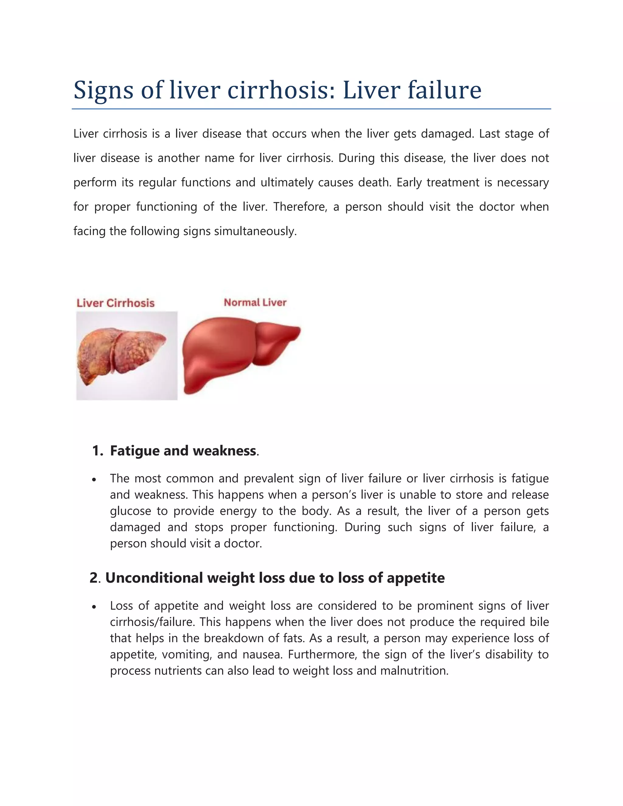 Signs of liver cirrhosis.pdf