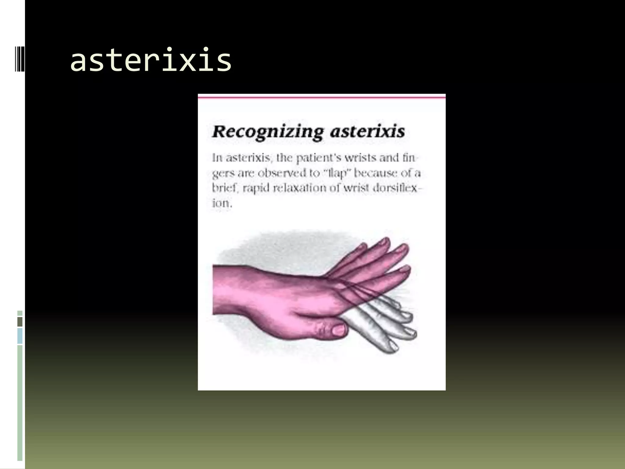 Signs of liver diseases | PPTX