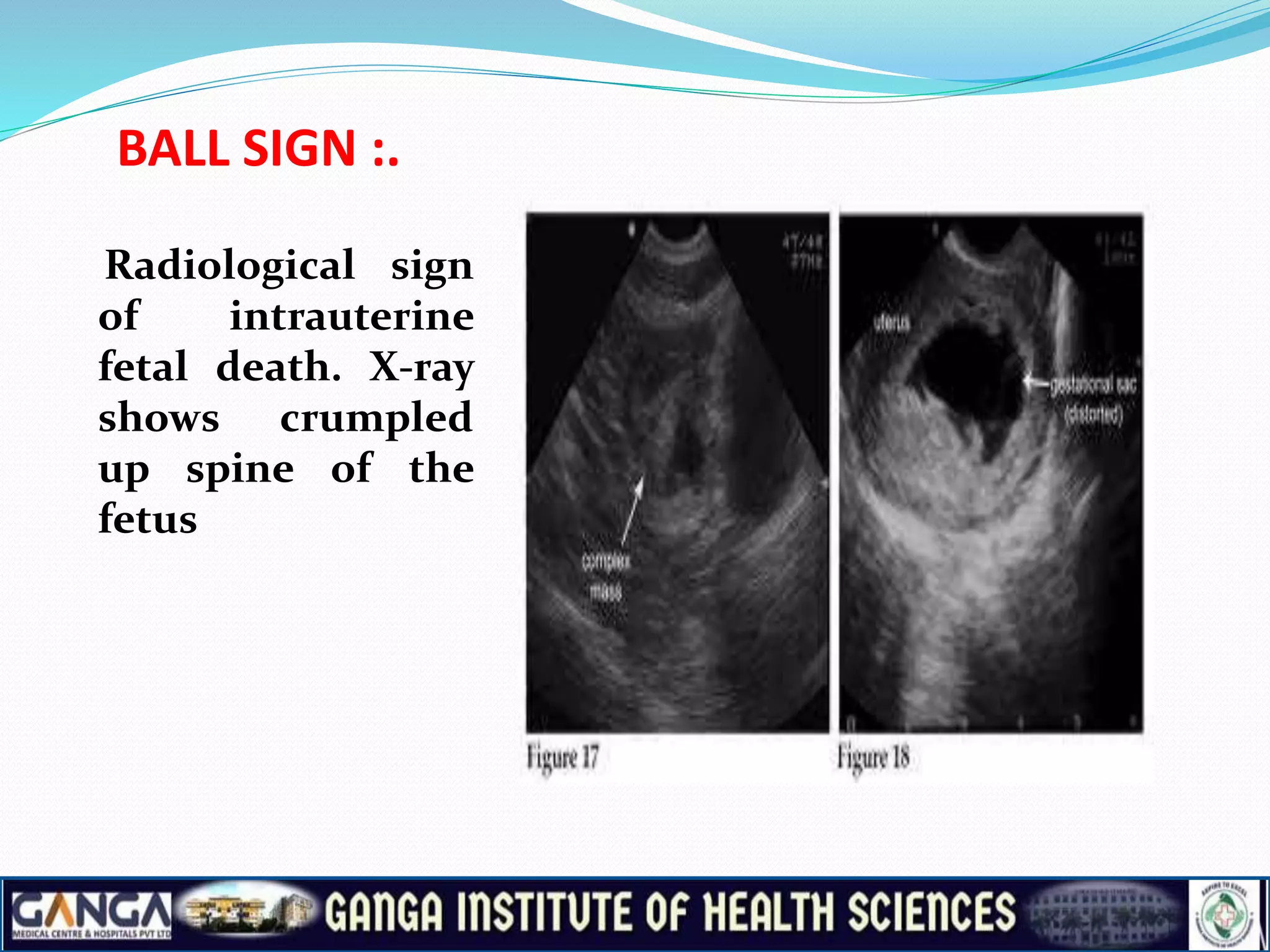 Signs of obstetrics.pptx