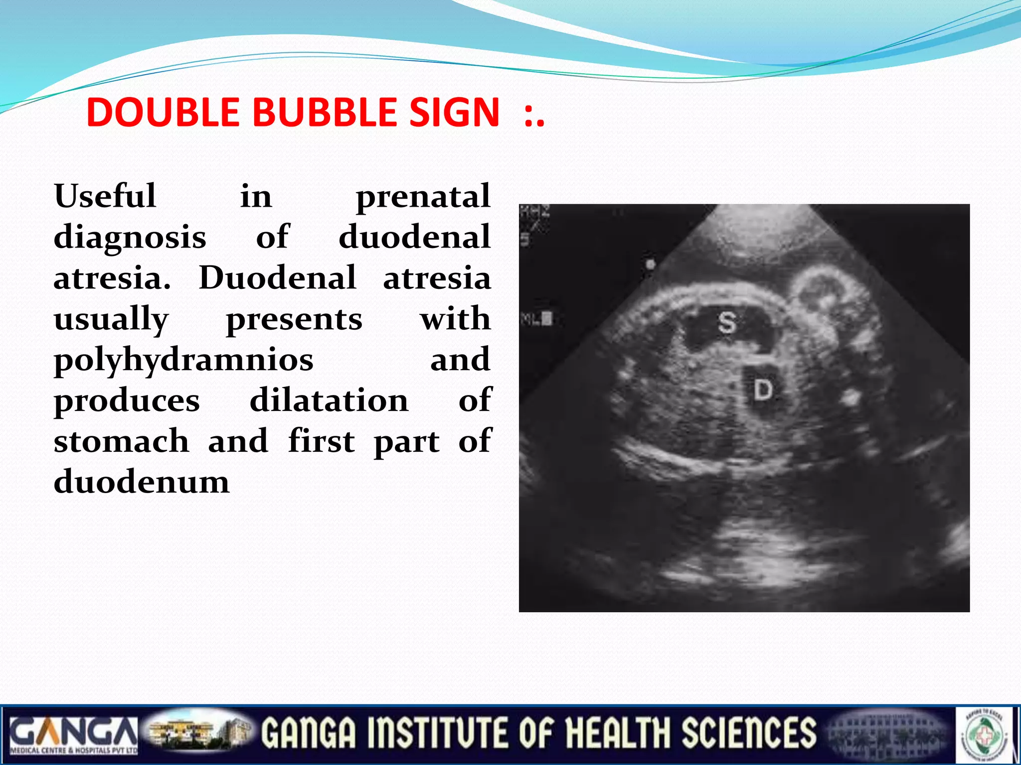 Signs of obstetrics.pptx