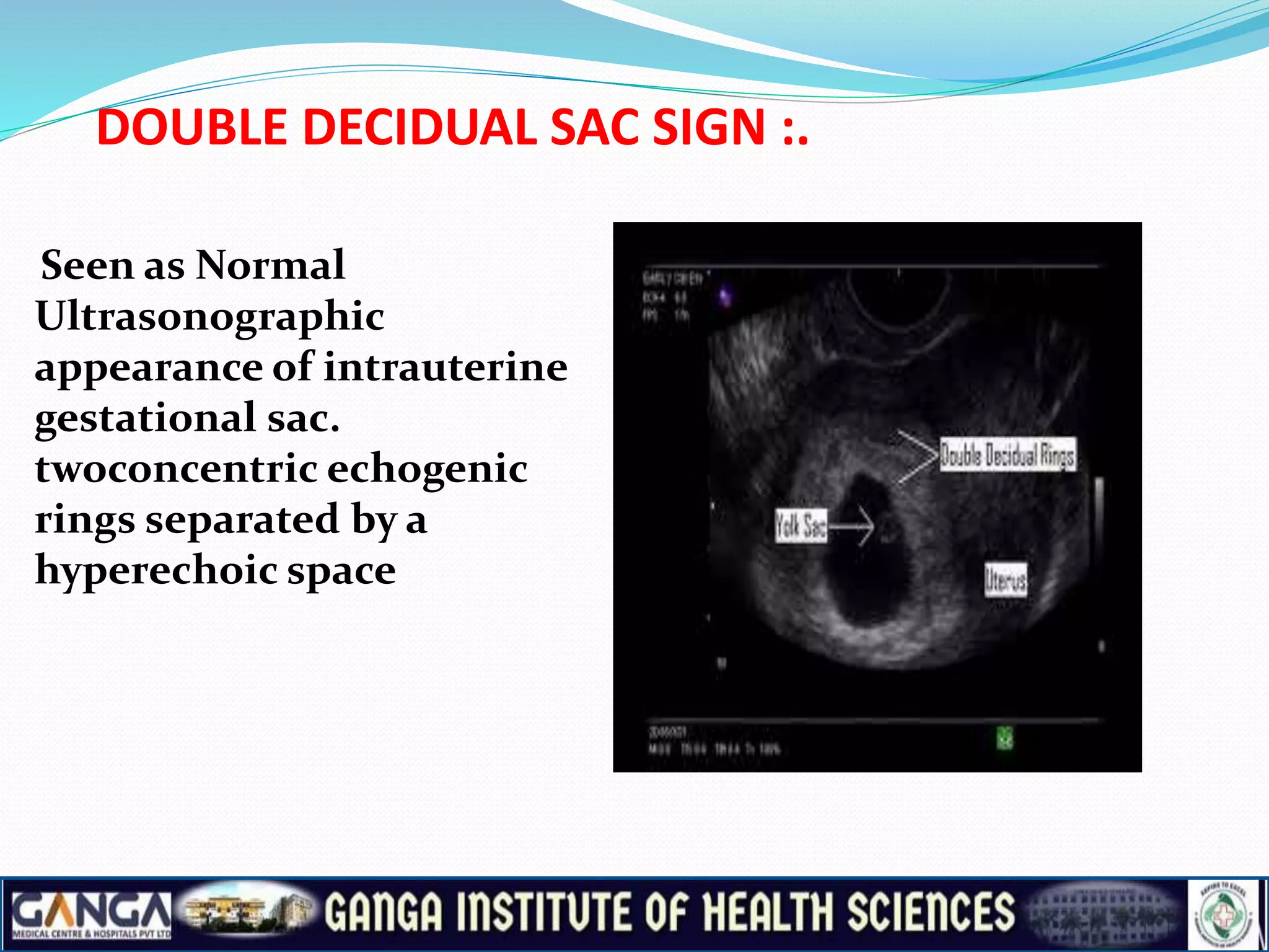 Signs of obstetrics.pptx