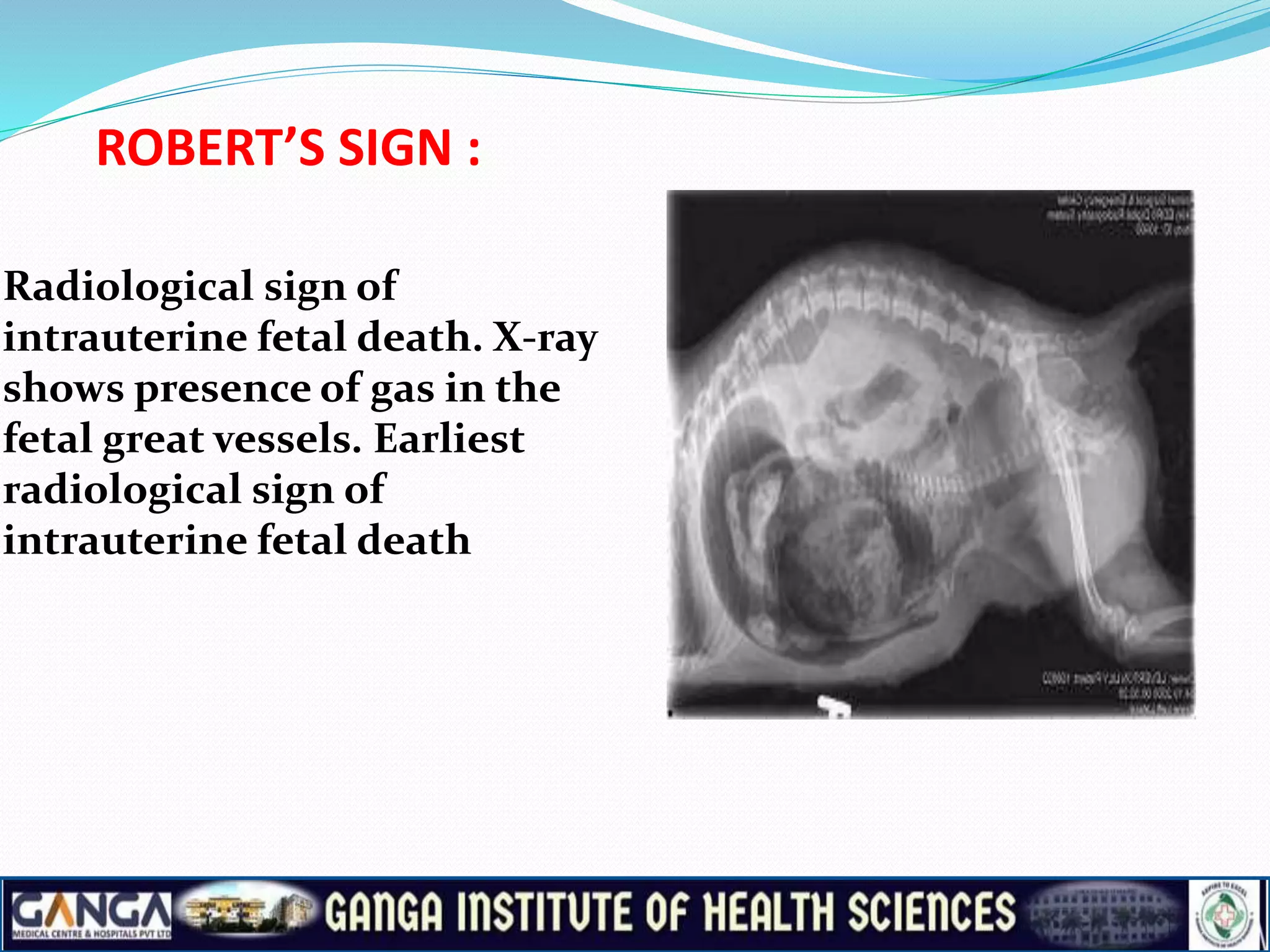 Signs of obstetrics.pptx