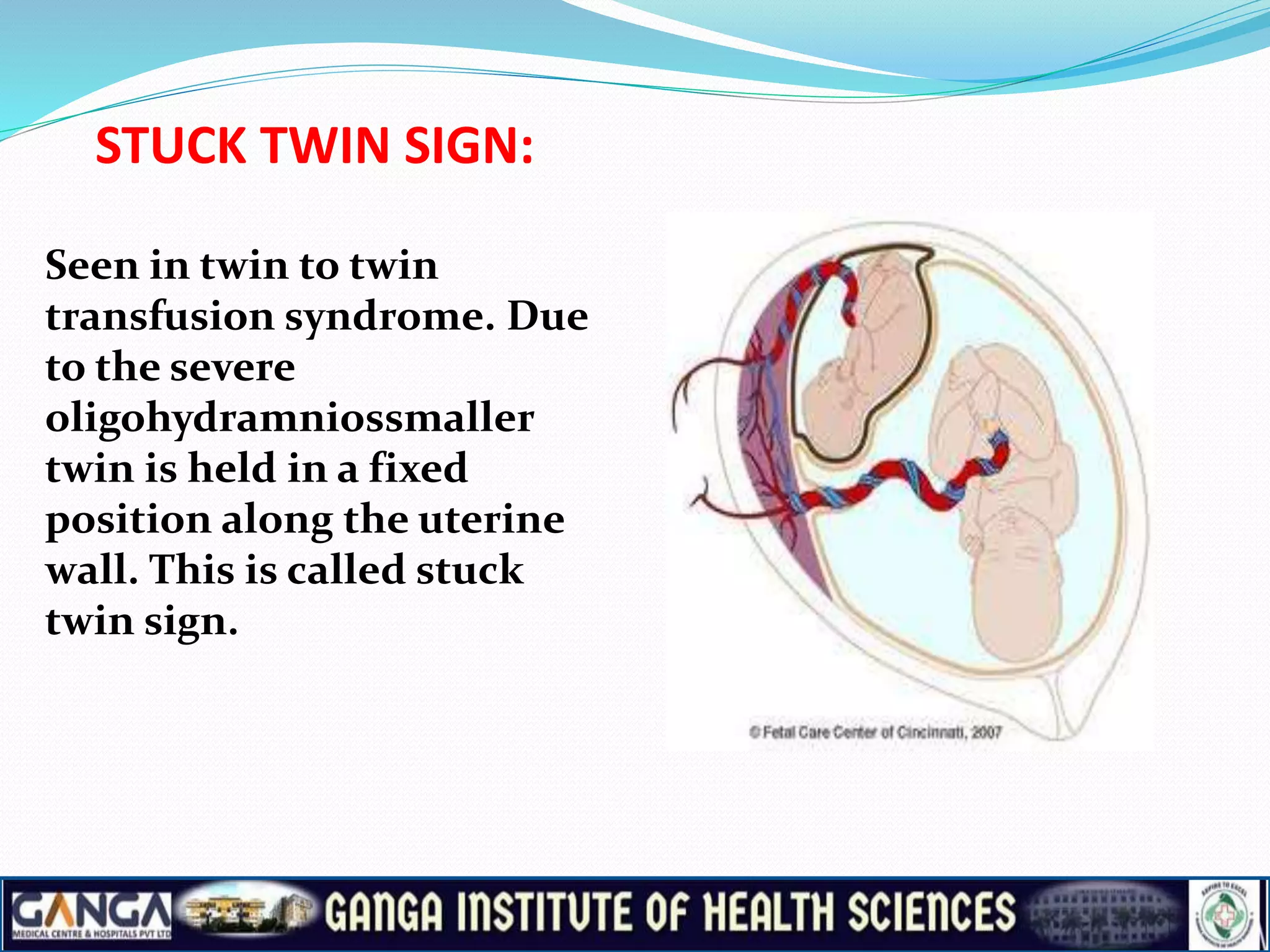 Signs of obstetrics.pptx