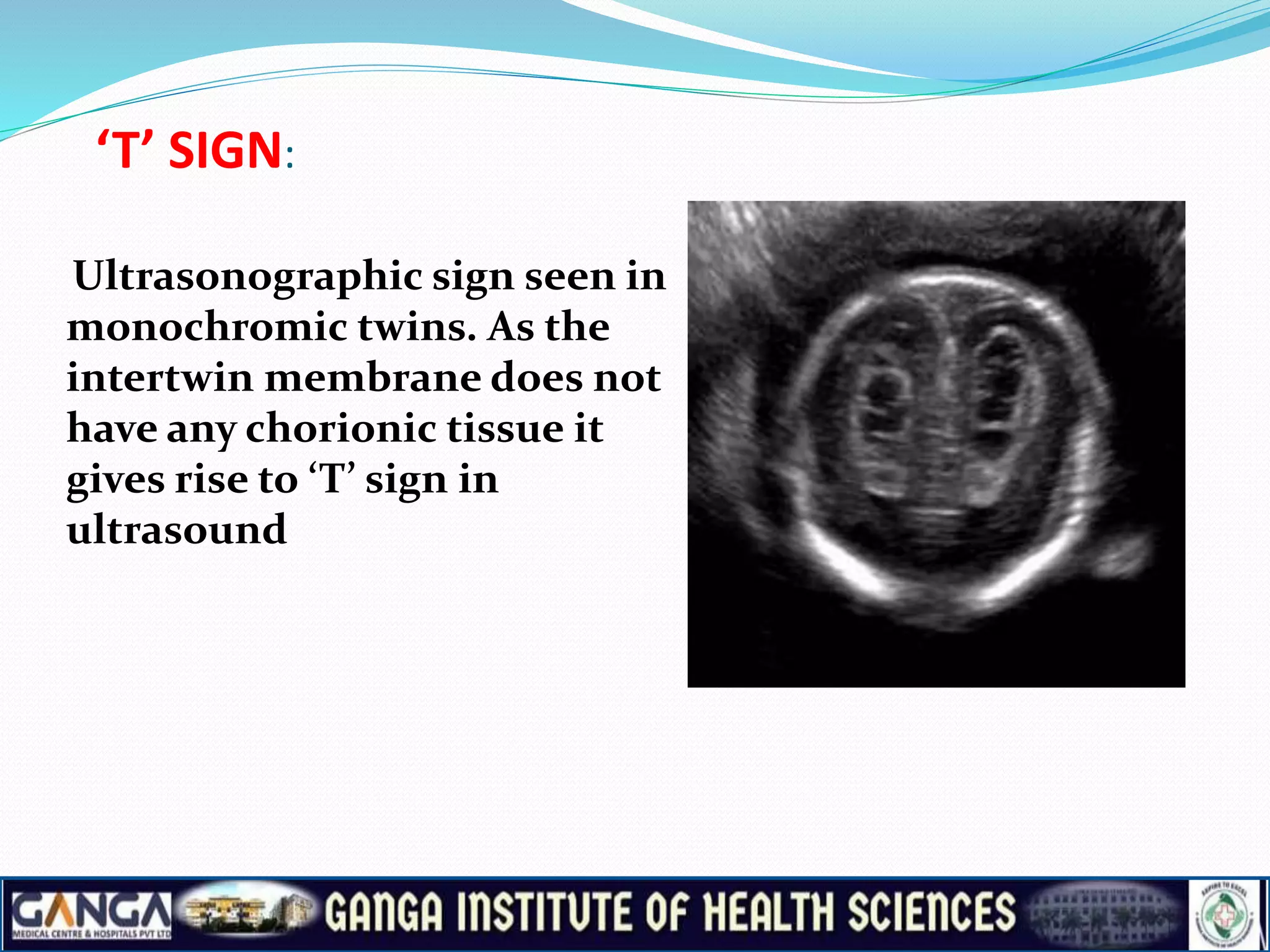 Signs of obstetrics.pptx