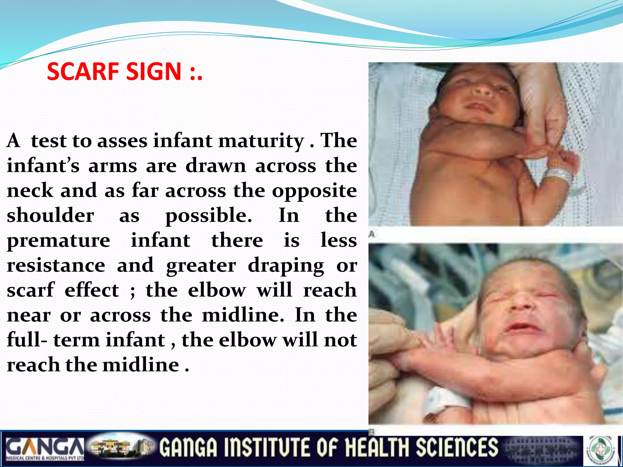 Signs of obstetrics.pptx