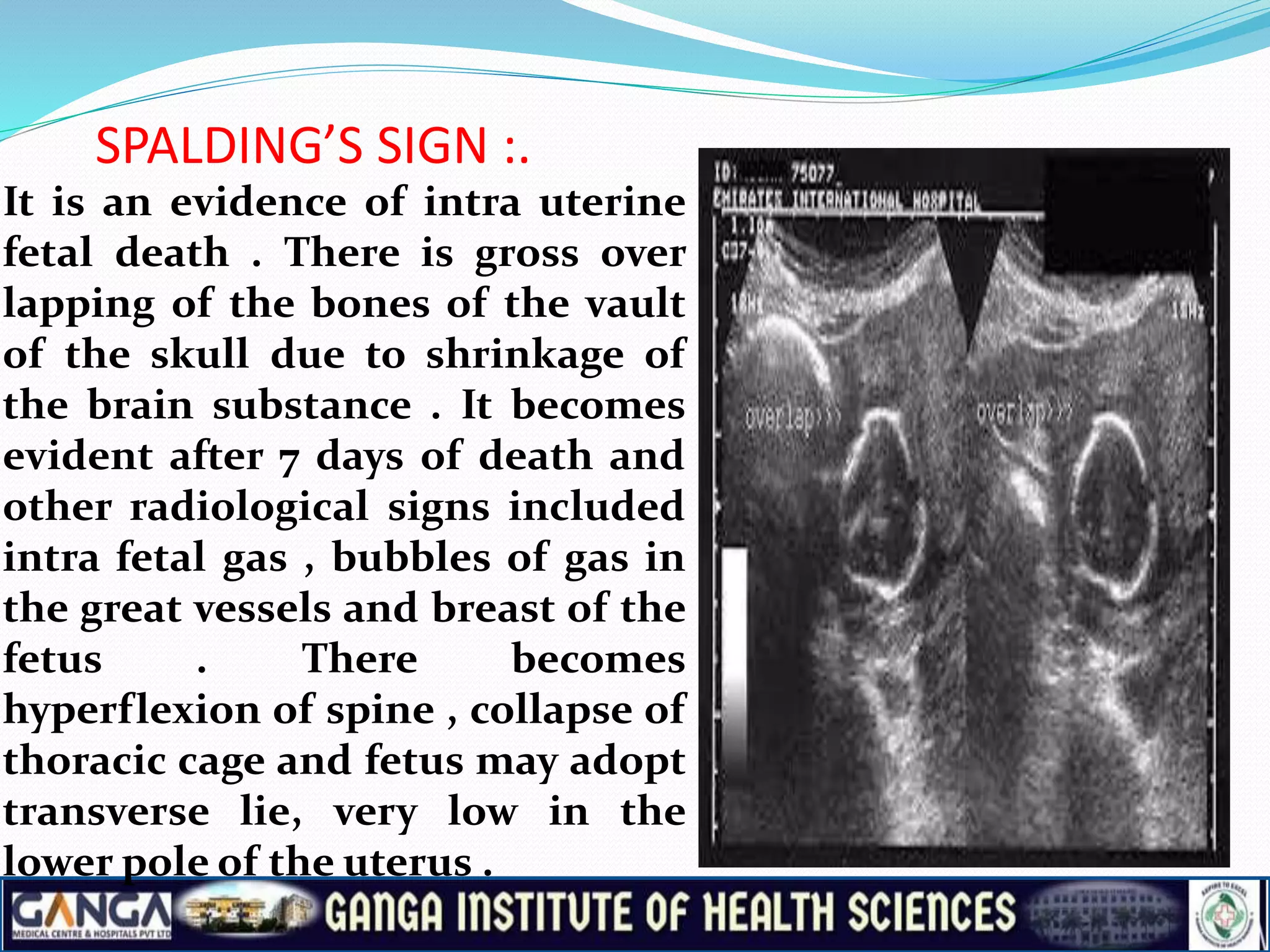 Signs of obstetrics.pptx