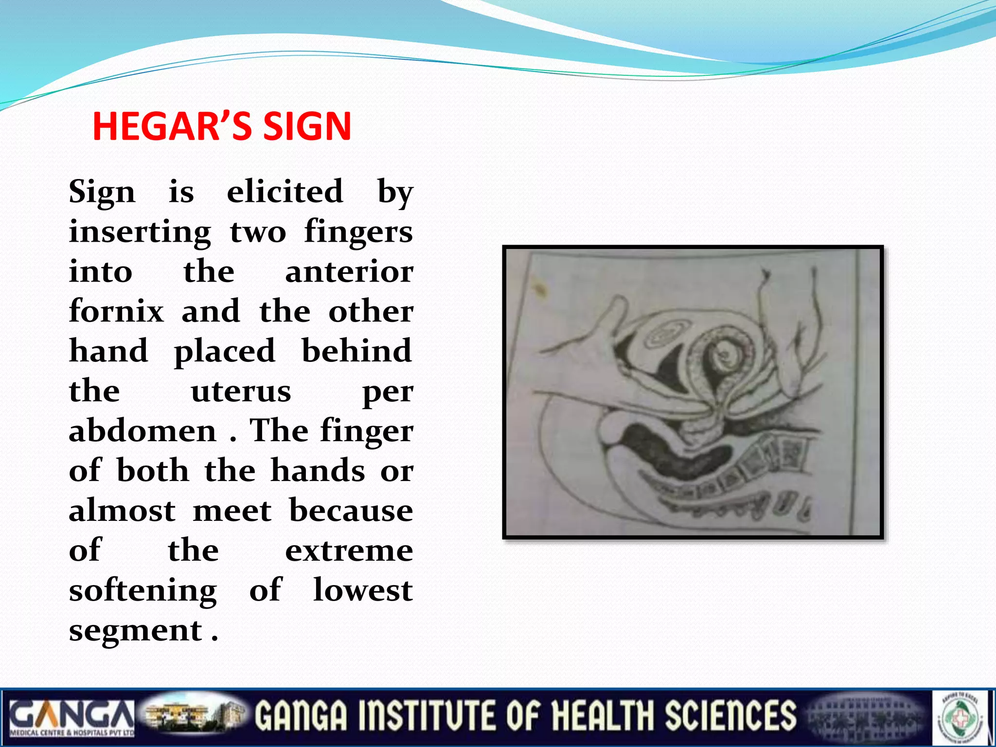 Signs of obstetrics.pptx