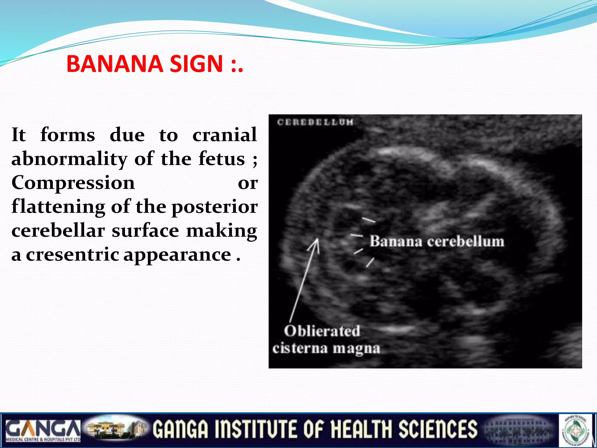 Signs of obstetrics.pptx