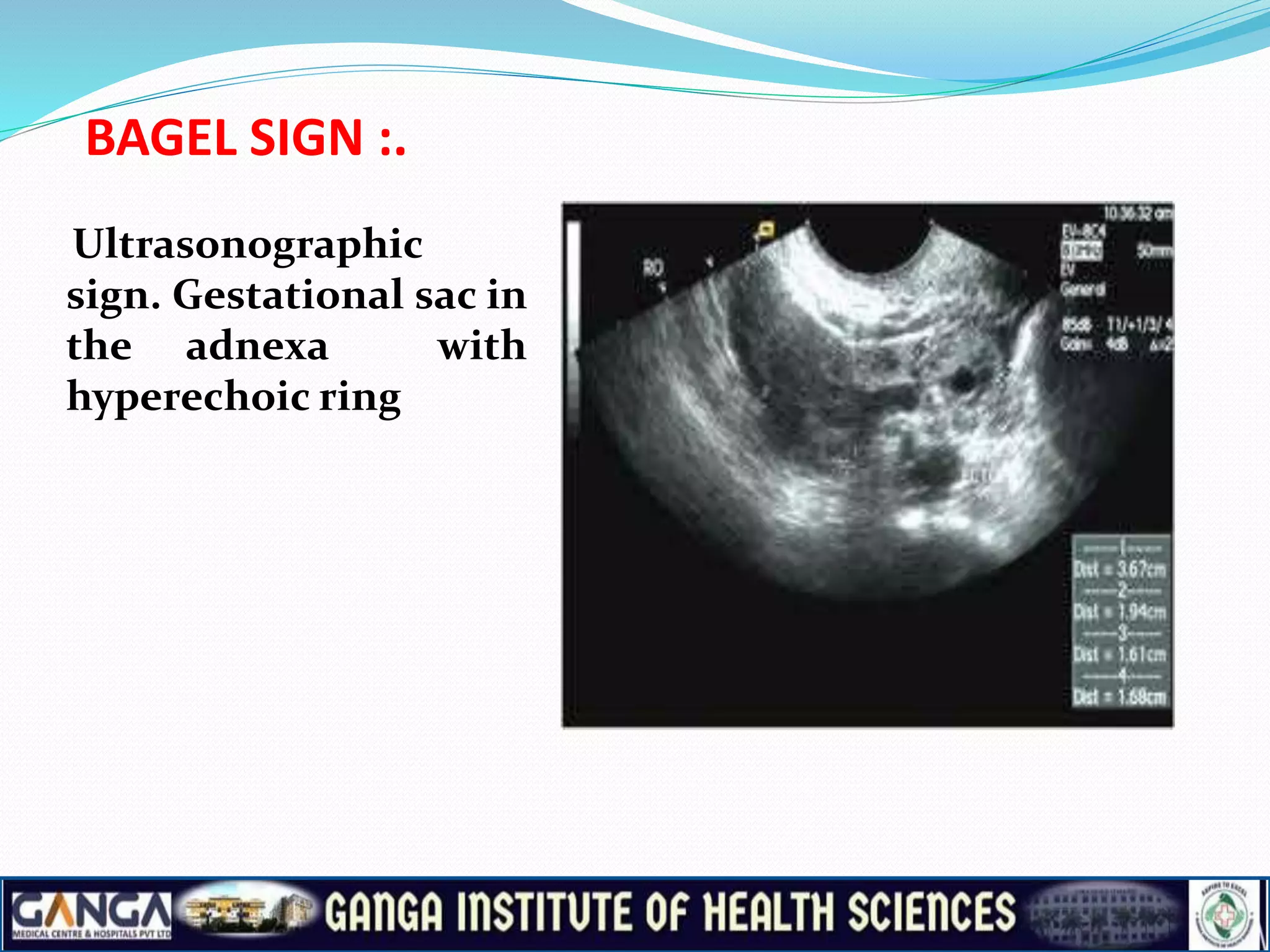 Signs of obstetrics.pptx