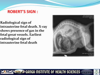 Signs of obstetrics.pptx