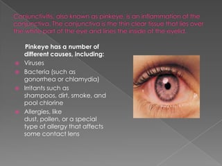 Signs of Pink Eye & its Diagnosis | PPTX
