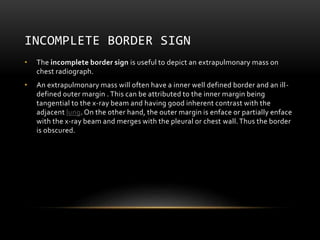 Signs of radiological importance in the thorax Dr.Sumit Sharma | PPTX