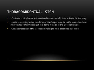 Signs of radiological importance in the thorax Dr.Sumit Sharma | PPTX