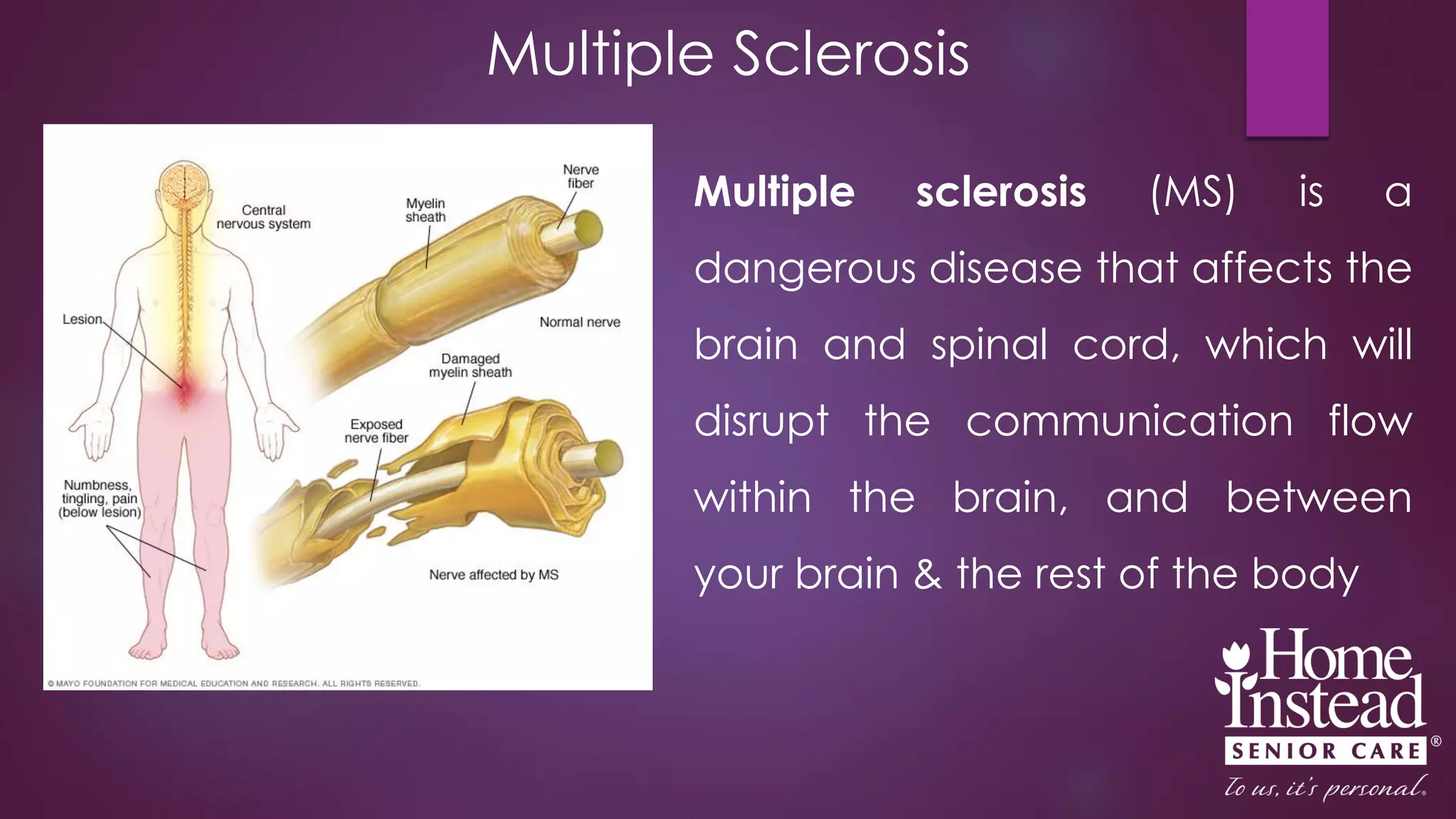 Signs & Symptoms of Multiple Sclerosis | PPT