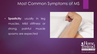 Signs & Symptoms of Multiple Sclerosis | PPT