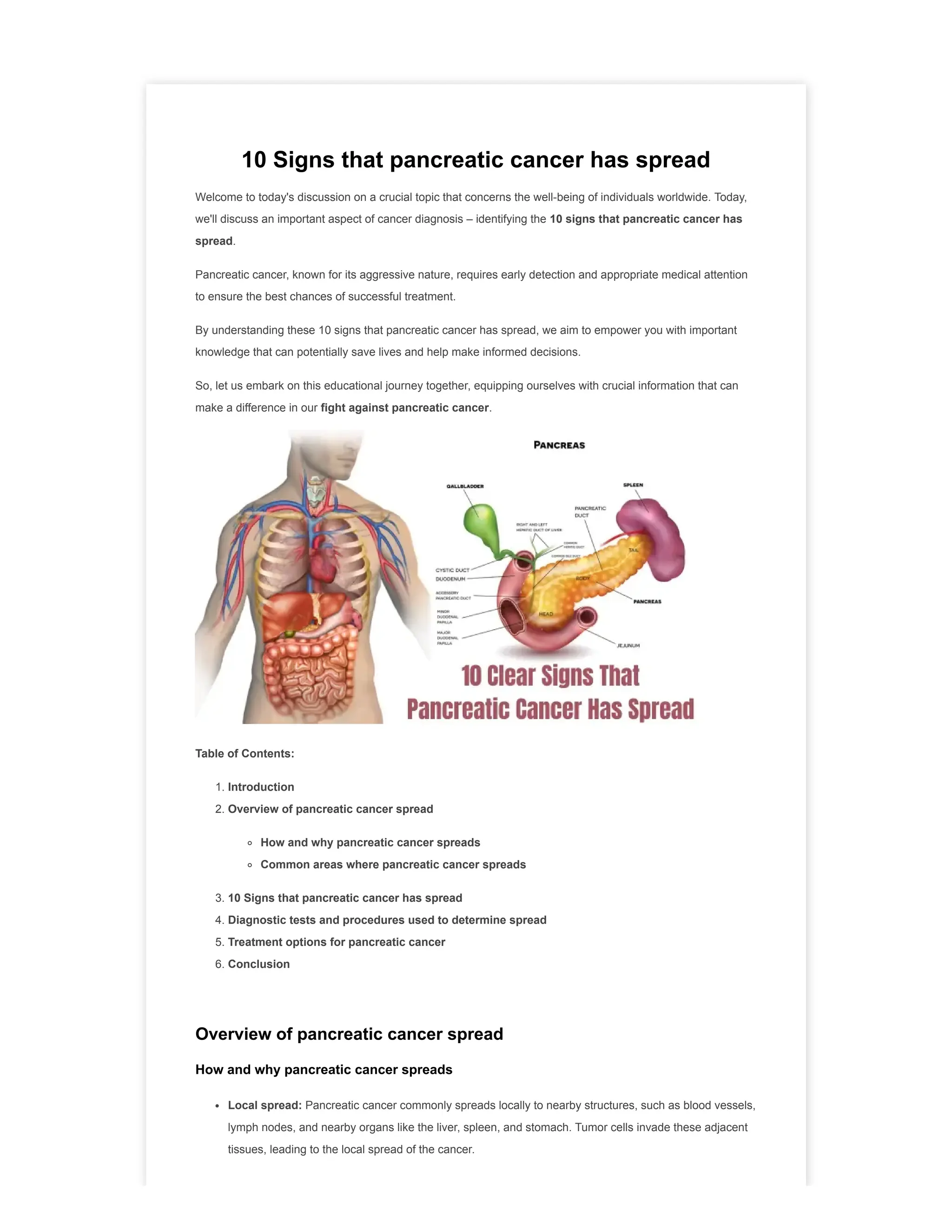 Signs that pancreatic cancer has spread.pdf