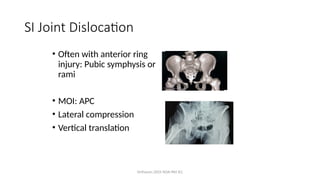 SI joint anterior plating surgical Technique and scopeNOA PAS.pptx