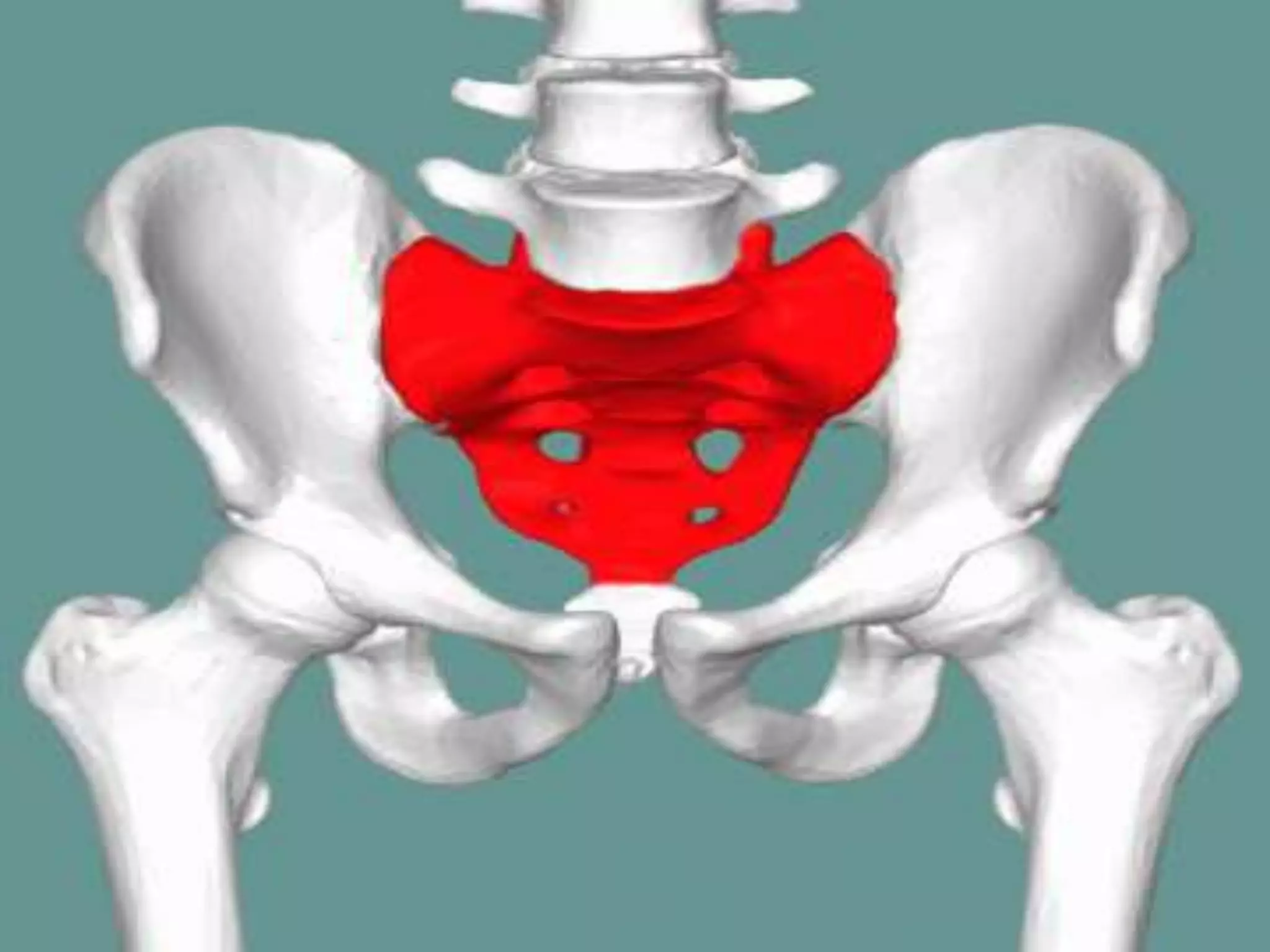 Si joint dysfunction | PPT