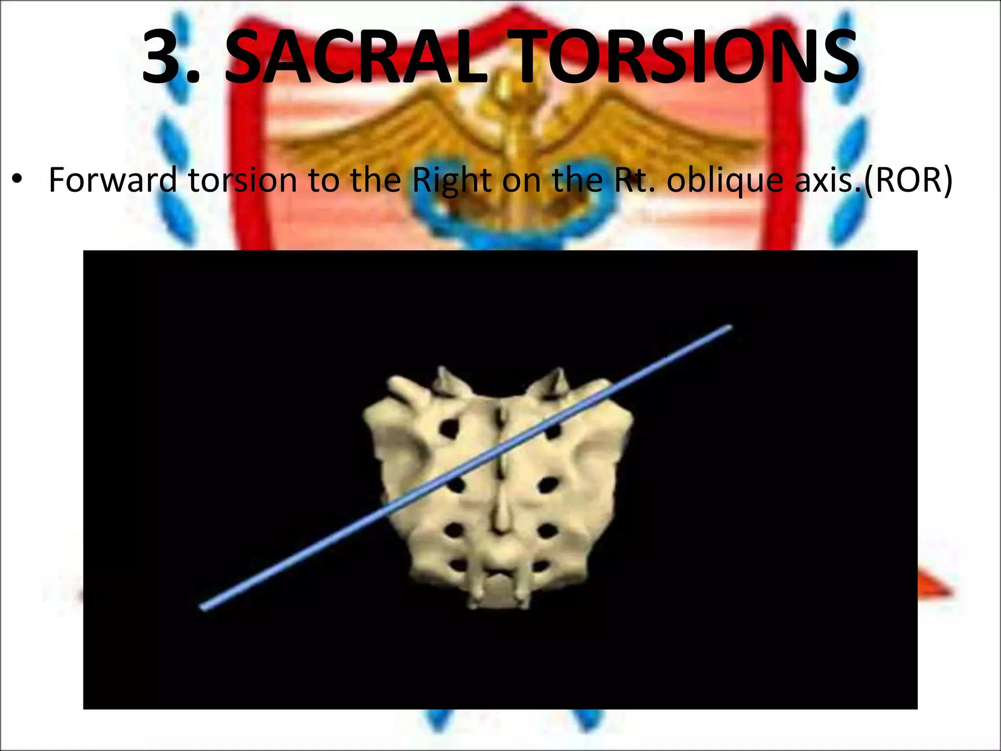 Si joint dysfunction | PPT