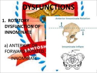 Si joint dysfunction | PPT