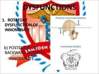 Si joint dysfunction | PPT