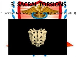 Si joint dysfunction | PPT