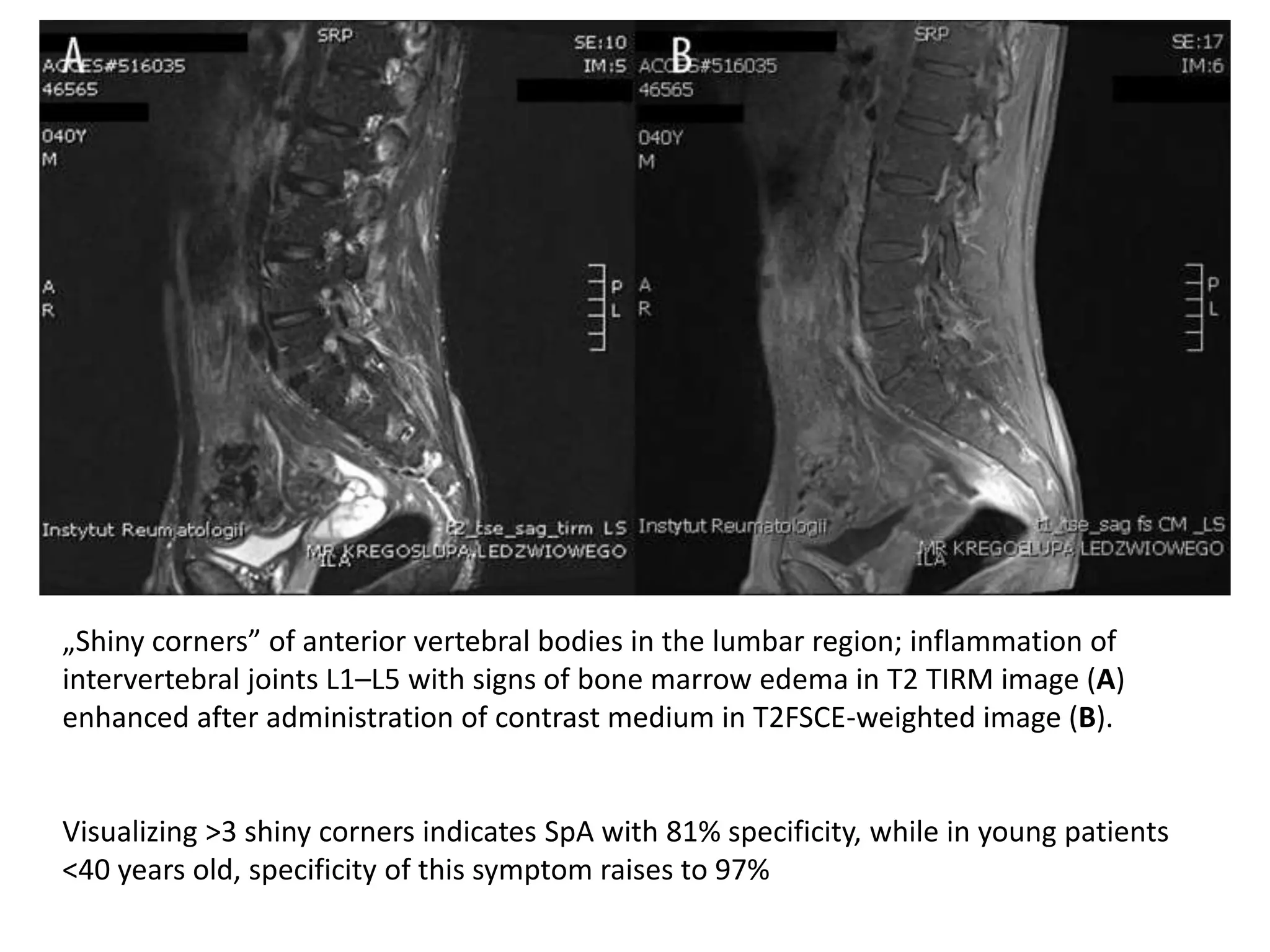 SI JOINT PATHOLOGIES.pptx