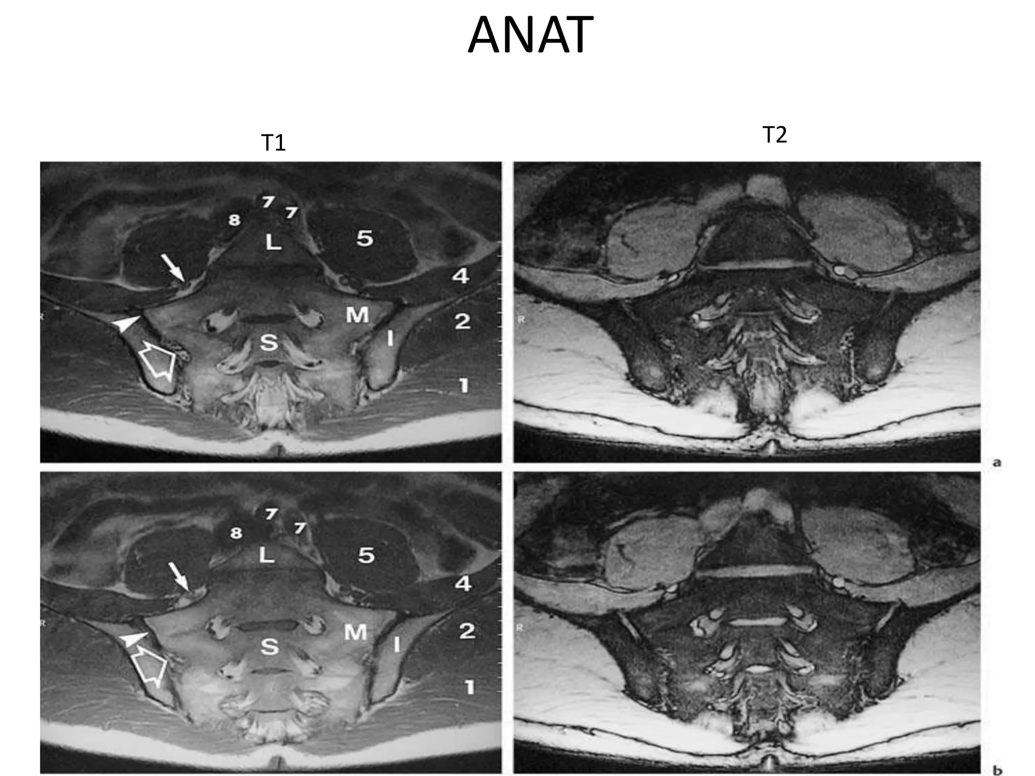 SI JOINT PATHOLOGIES.pptx